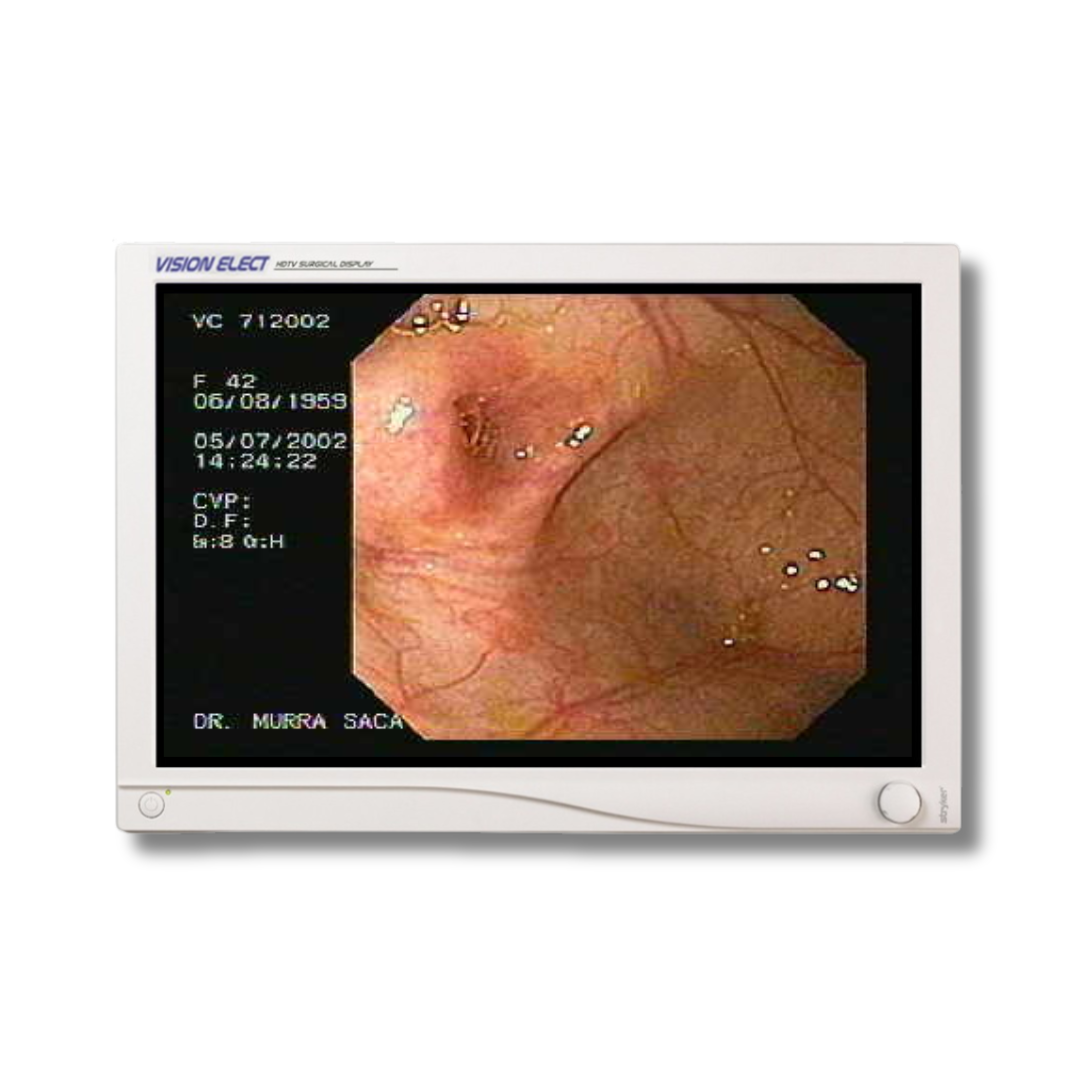 Stryker Vision Elect 26" Medical Monitor – GSMED | Equipos médicos para ...